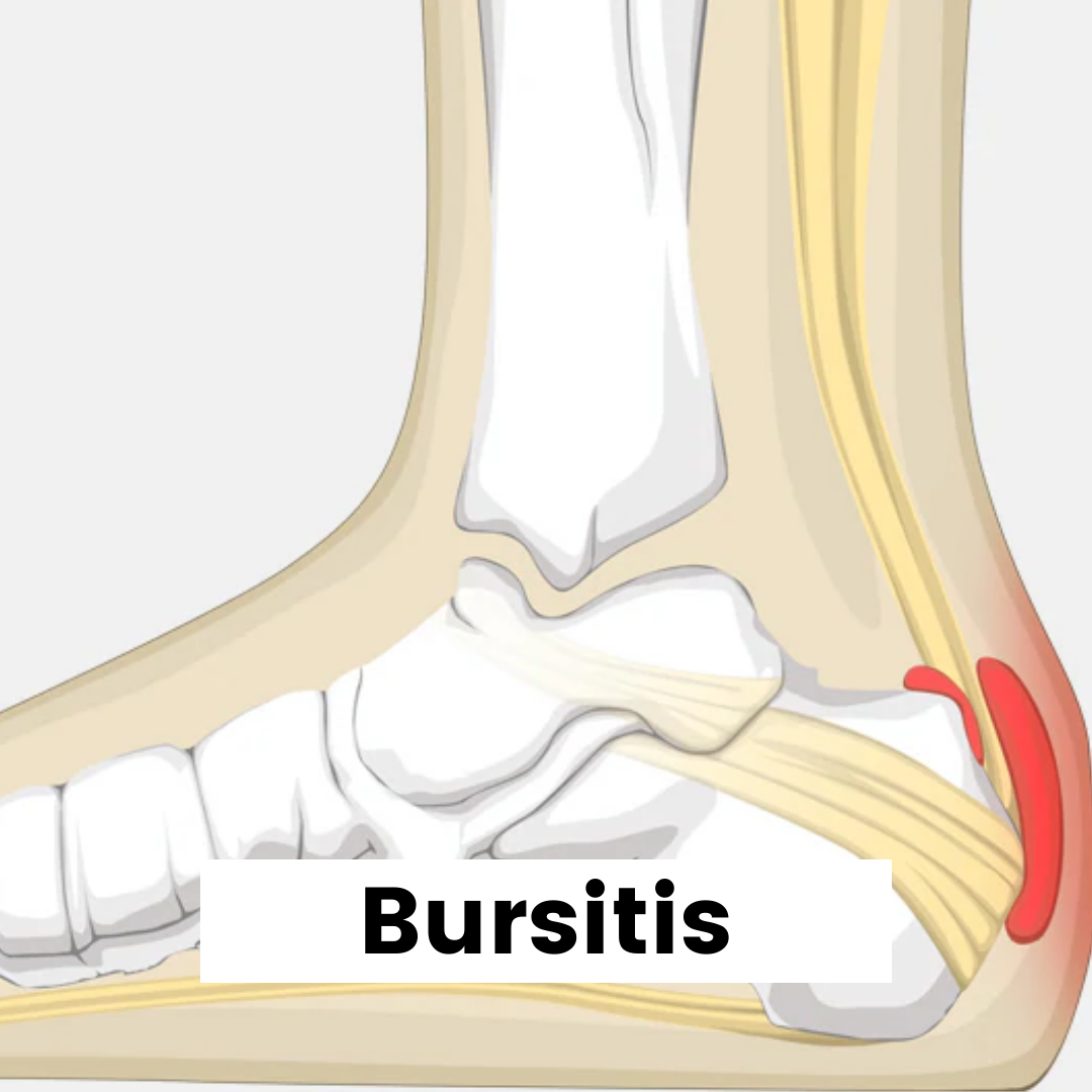 Common Conditions - Gold Standard Foot & Leg Clinic